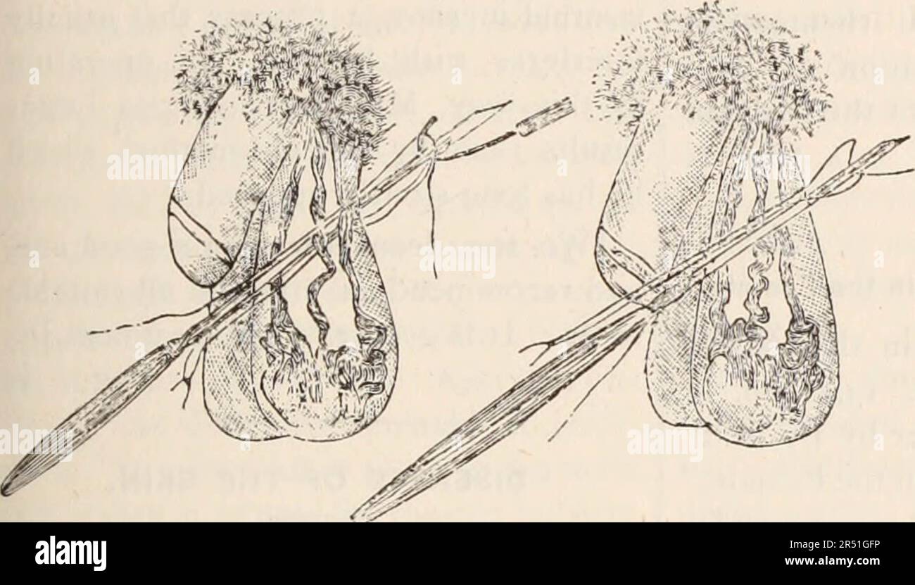 "American medical digest." (1886 Stock Photo - Alamy