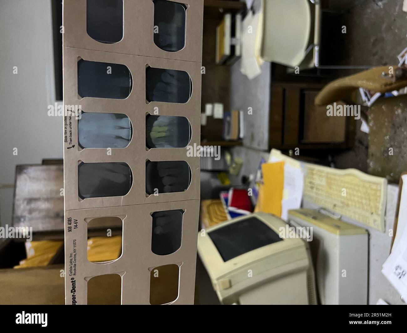 X-rays of people's teeth. ALABAMA, USA: CREEPY IMAGES have been ...