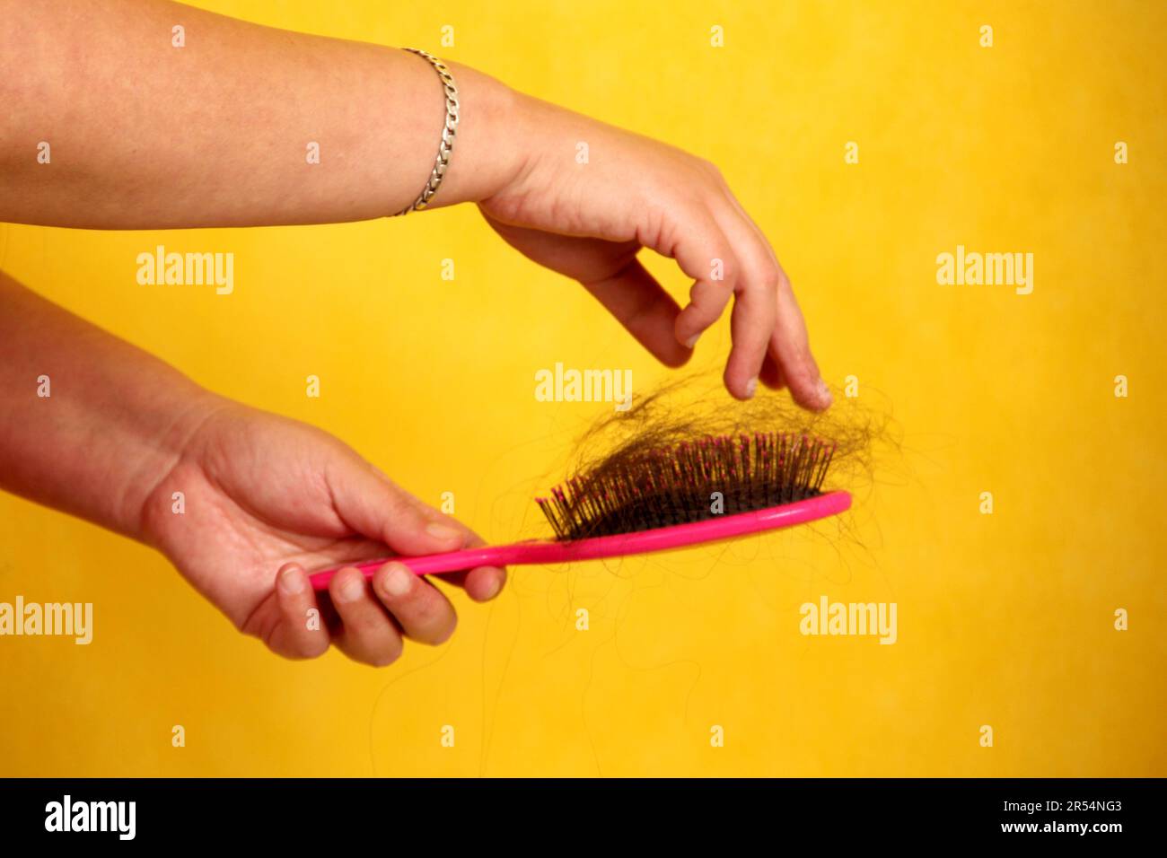 Adult Latina woman suffers from hair loss when brushing it, a symptom ...