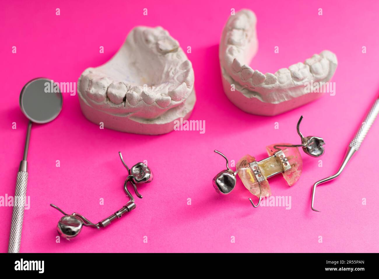 Dental casting gypsum model plaster cast stomatologic human jaws ...