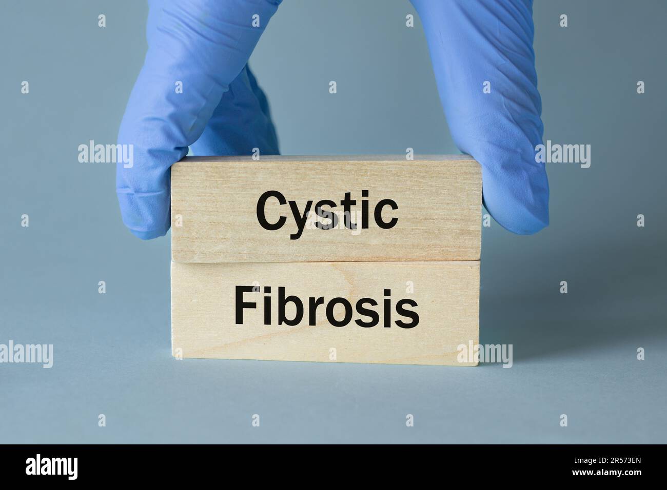 Cystic fibrosis (CF) a rare genetic disease that affects the lungs, but ...