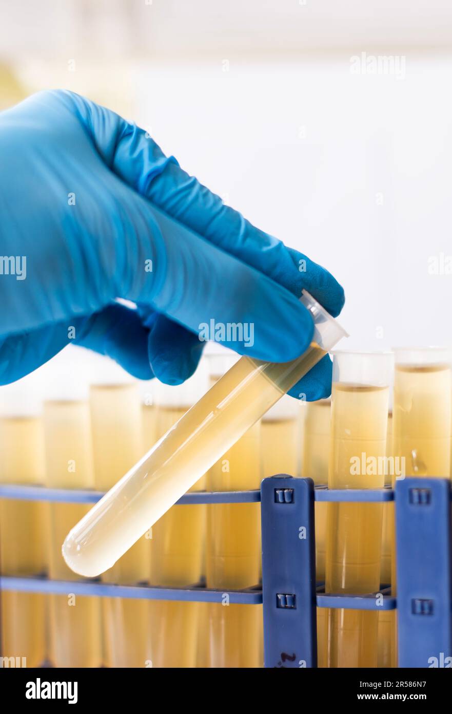 In vitro cellular assay using multi pipette and well plate cell culture ...
