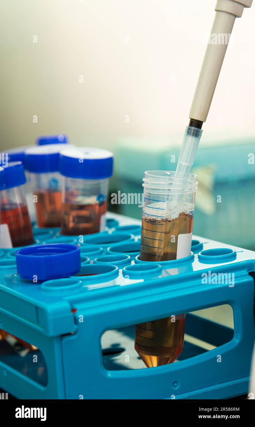 In vitro cellular assay using multi pipette and well plate cell culture ...