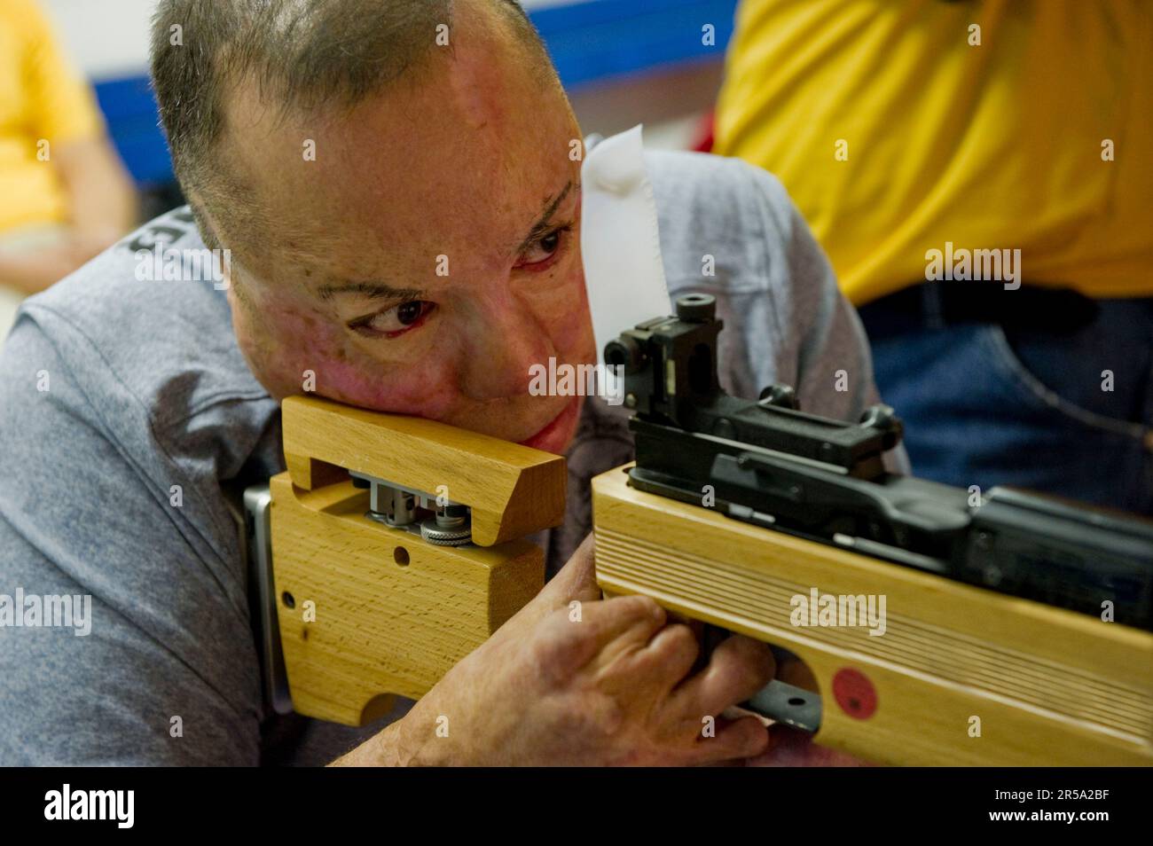An athlete, who is covered with burn scars, sites his air rifle during ...