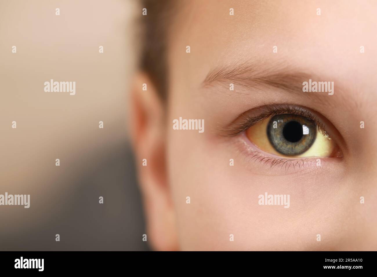 Closeup view of little girl with yellow eyes on blurred background ...