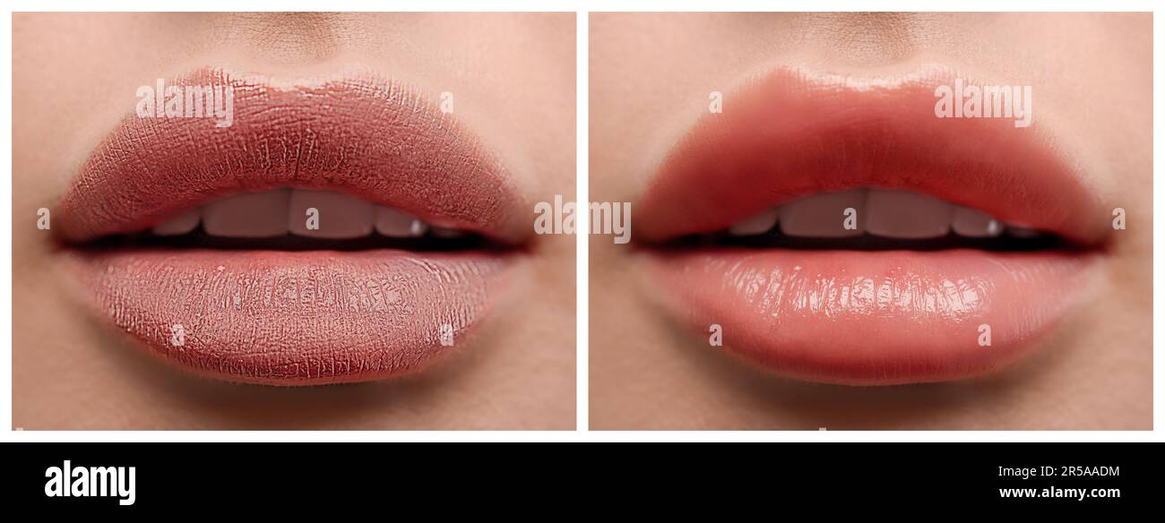 Collage with photos of woman before and after applying cosmetic balm on ...