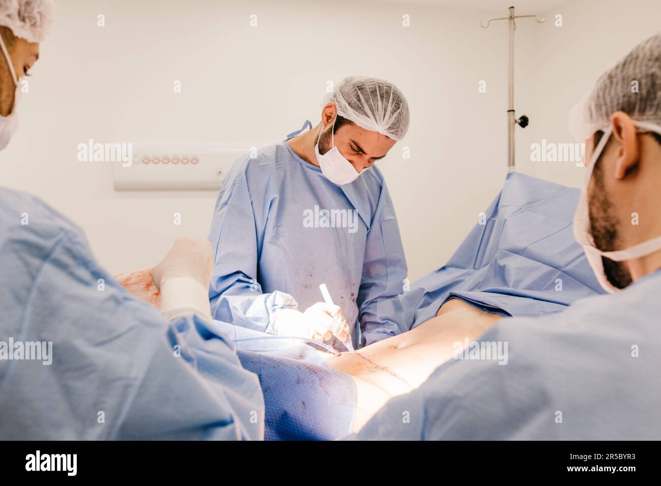 The medical professionals performing a surgical procedure in an ...