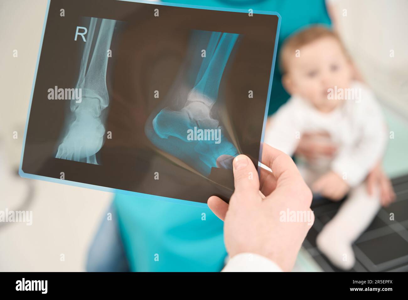 Radiographer examining x-ray of infant lower extremity in two ...