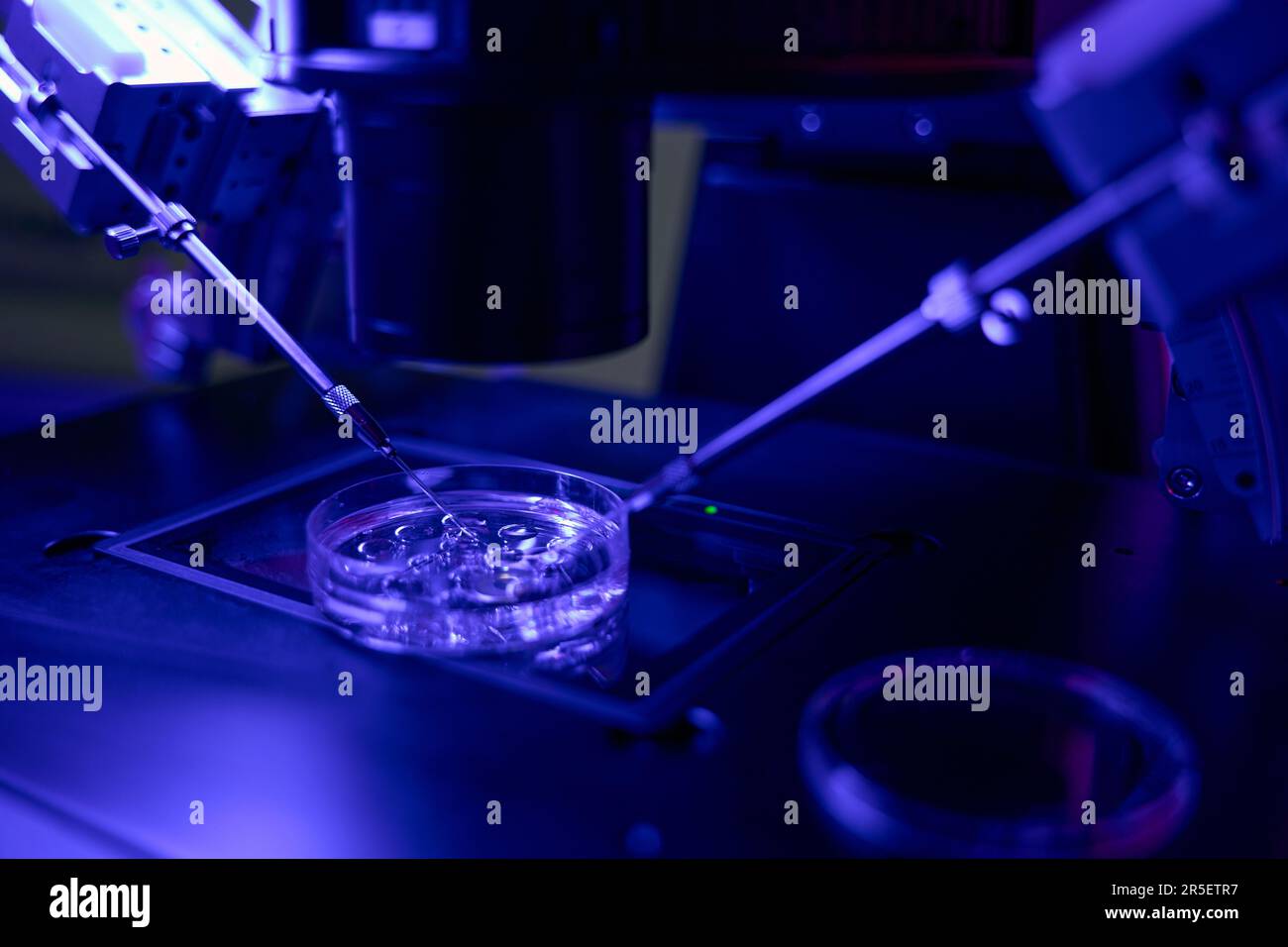 Micromanipulator catching spermatozoa to make injection into oocyte ...