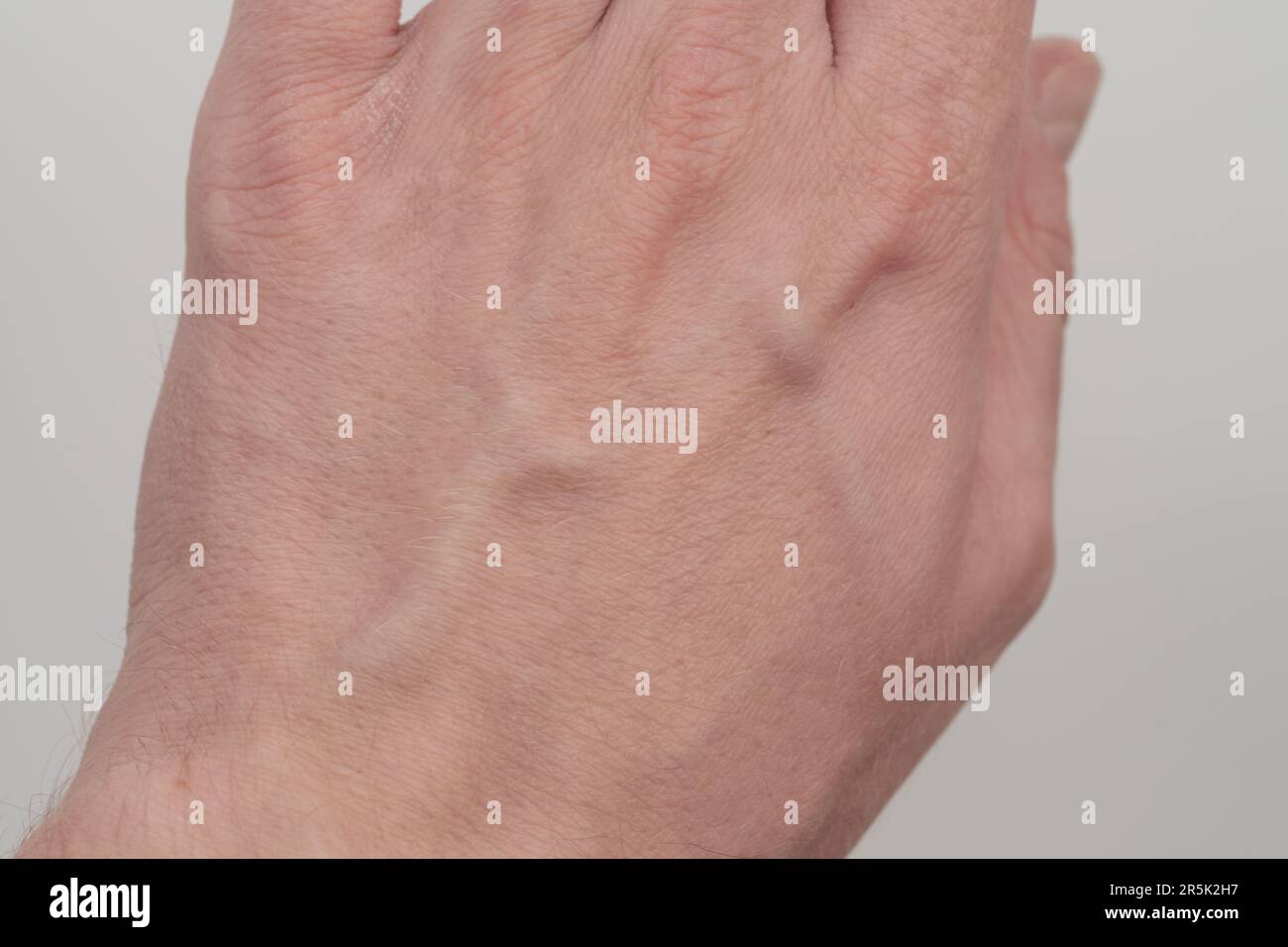 Finger veins hi-res stock photography and images - Alamy