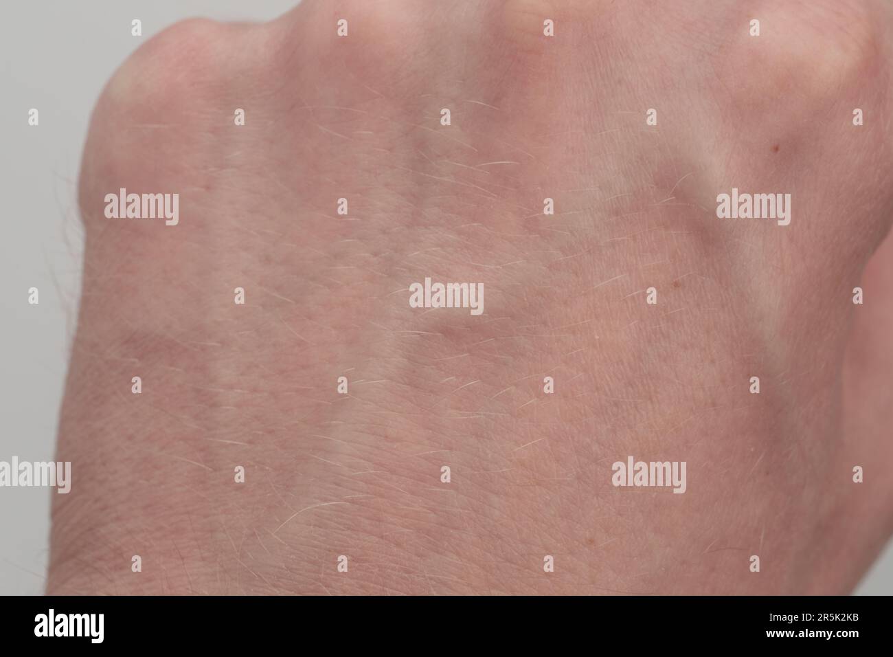 Finger veins hi-res stock photography and images - Alamy