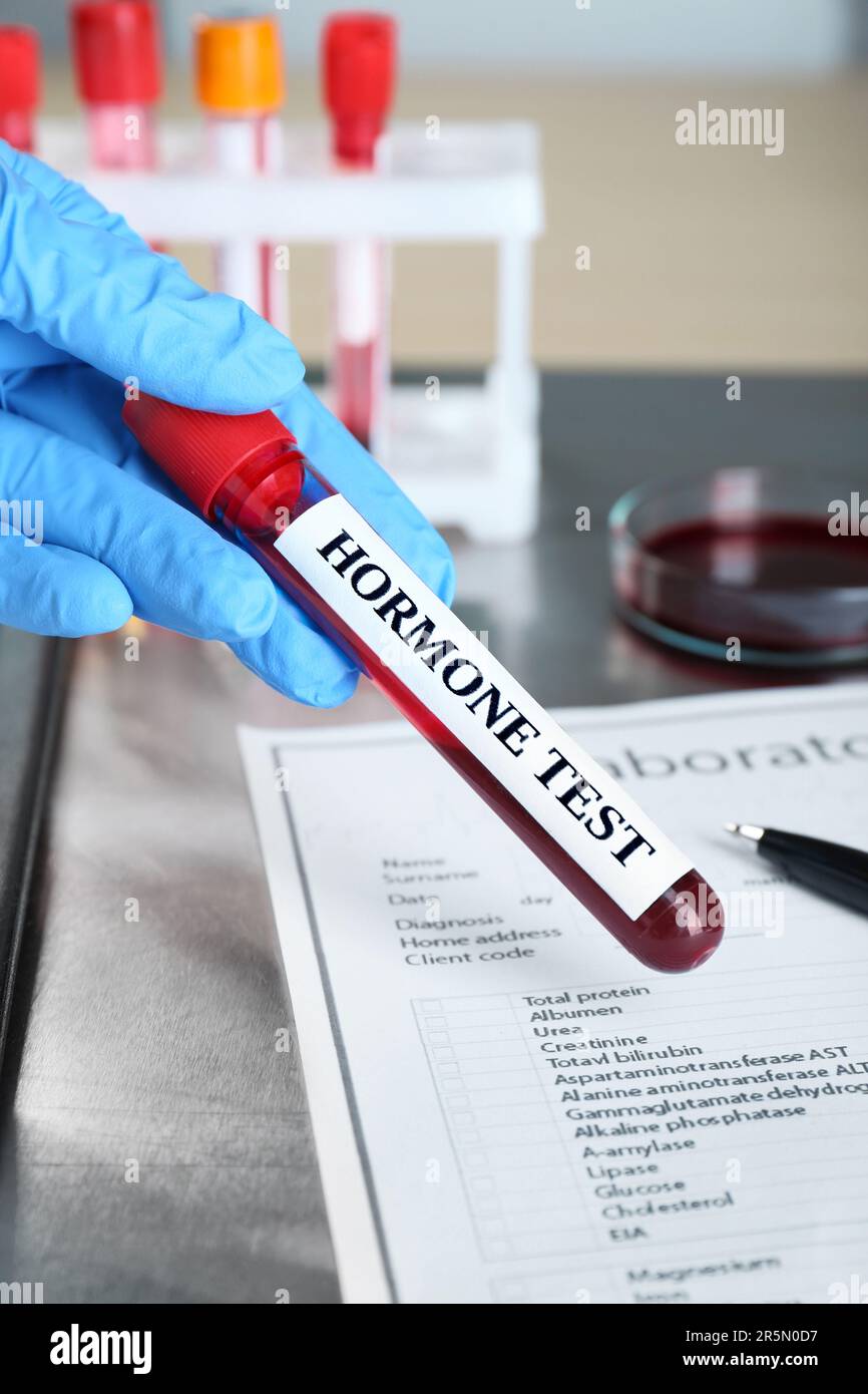 Doctor holding glass tube with blood sample and label Hormone Test at ...