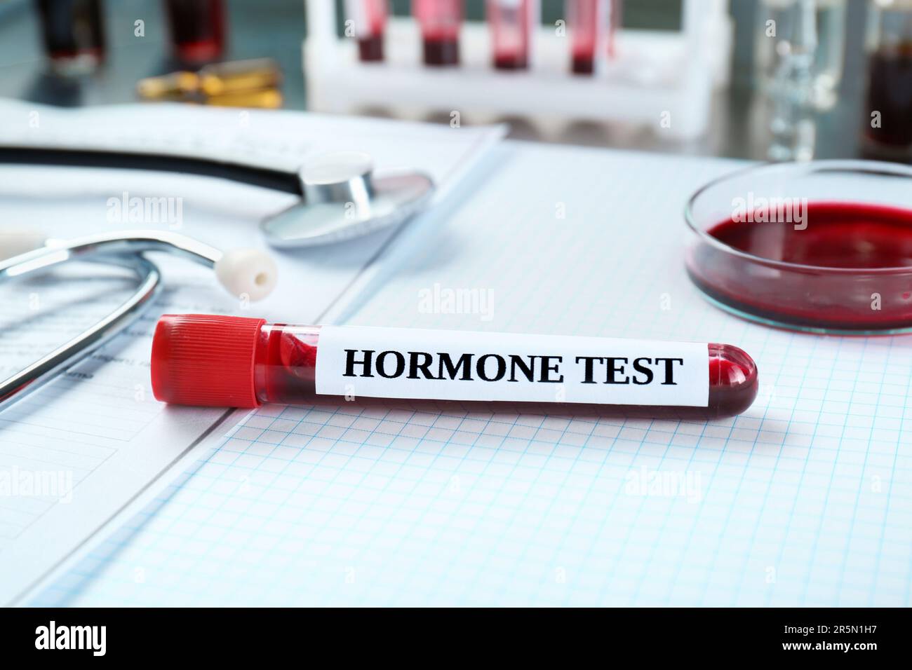 Glass tube with blood sample and label Hormone Test on table Stock ...