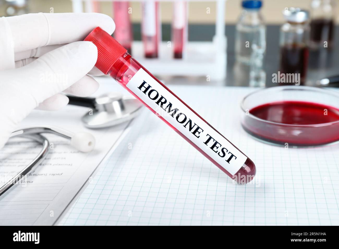 Doctor holding glass tube with blood sample and label Hormone Test at ...