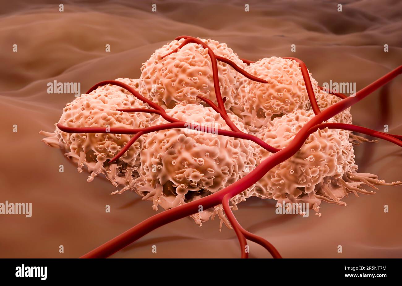 Angiogenesis hi-res stock photography and images - Alamy