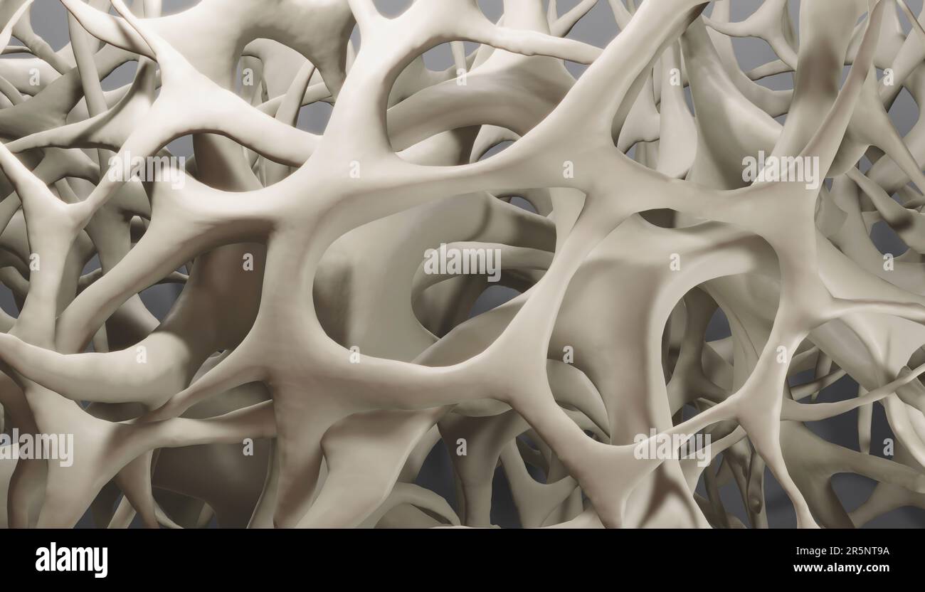 Fragile bone syndrome hi-res stock photography and images - Alamy