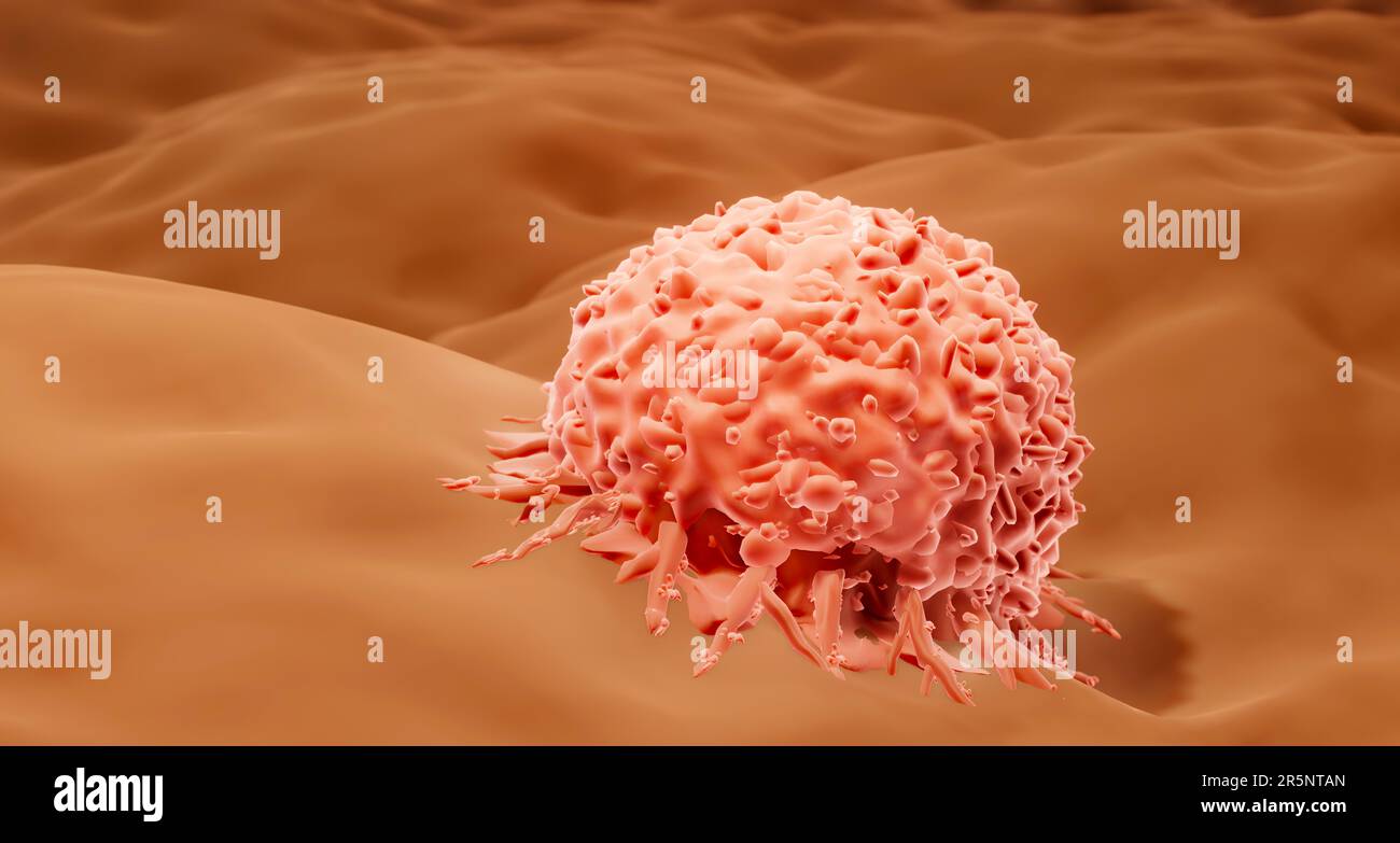Skin cancer cell, illustration Stock Photo - Alamy