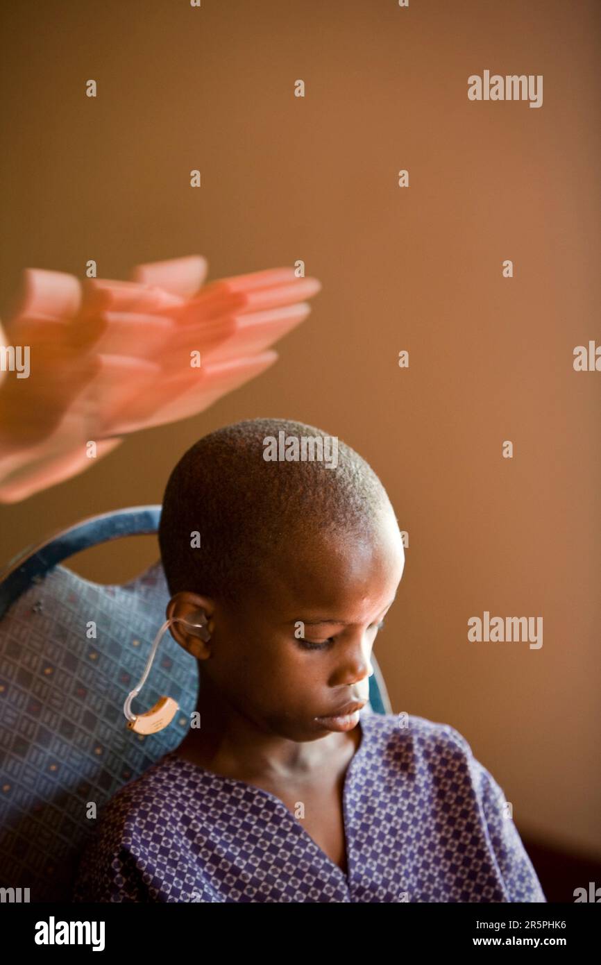 A deaf boy does not hear the clapping above his head despite strong ...