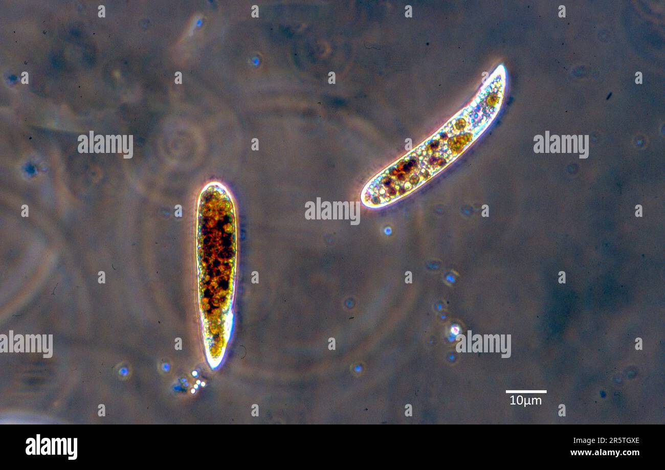 Ciliates (Helicostoma sp., H. nonatum?) known to be feeding on the ...
