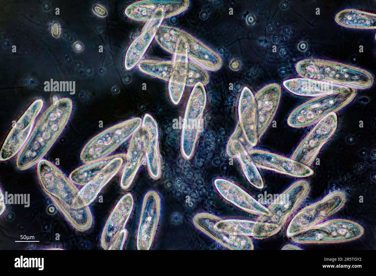 Ciliates, probably Paramecium sp Stock Photo - Alamy