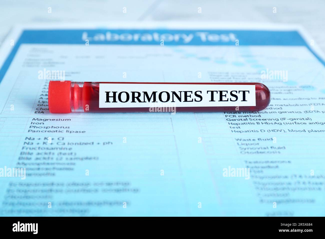 Hormones test. Sample tube with blood on laboratory form Stock Photo ...