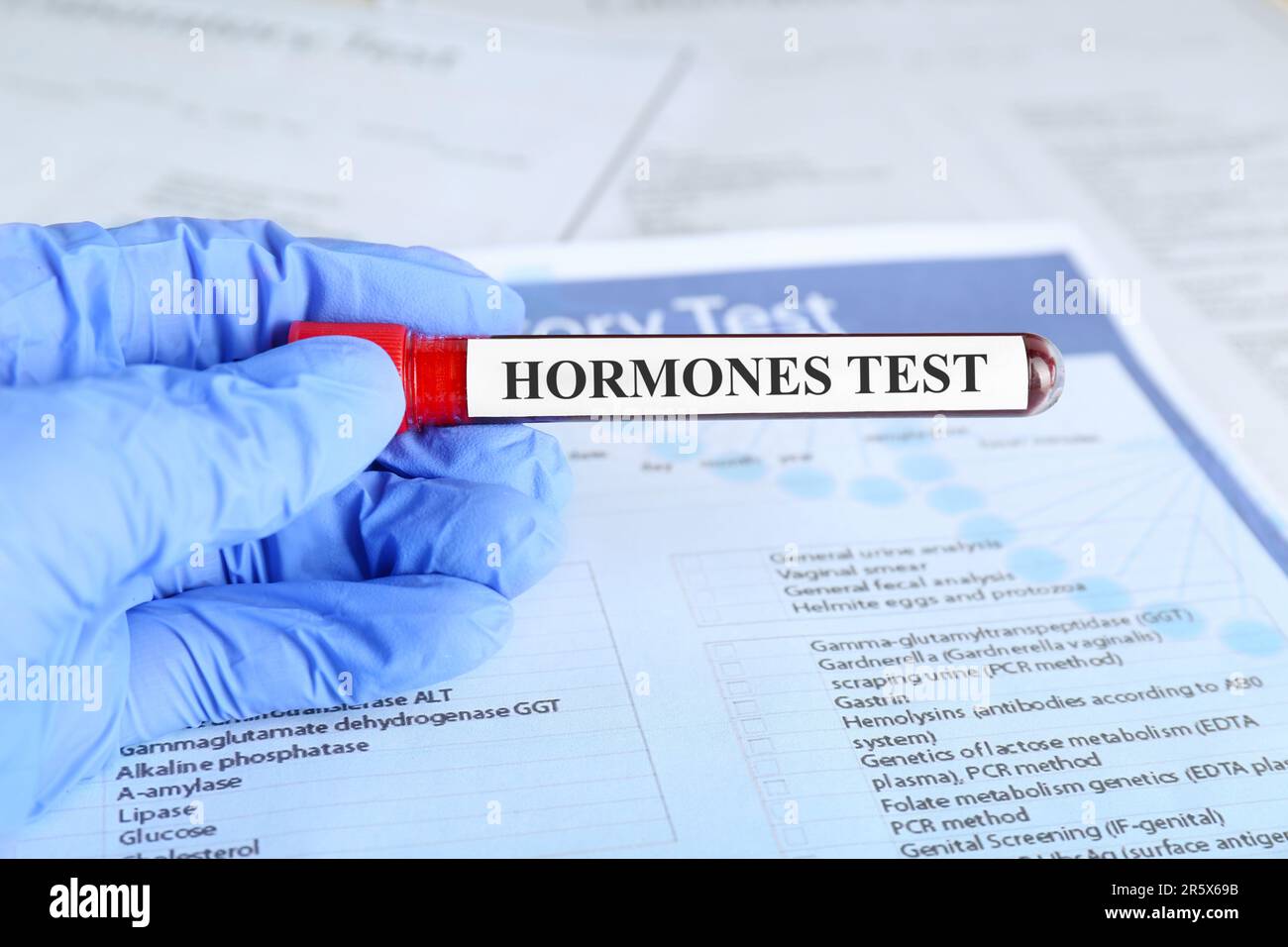 Hormones test. Scientist holding sample tube with blood against ...