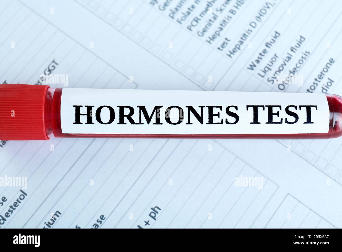 Hormones test. Sample tube with blood on laboratory form, top view ...