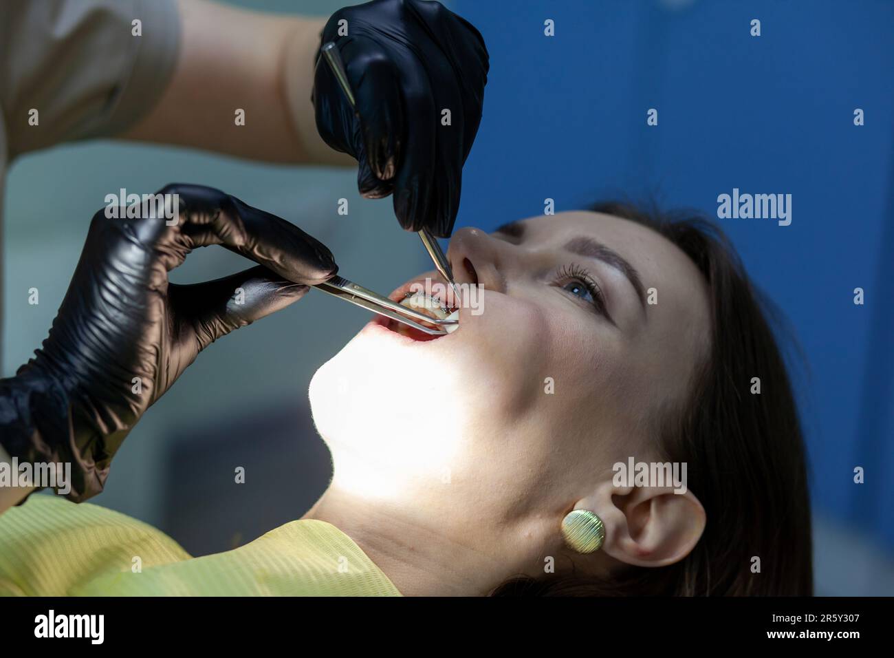 The process of removing braces.Beautiful woman in dental chair during ...