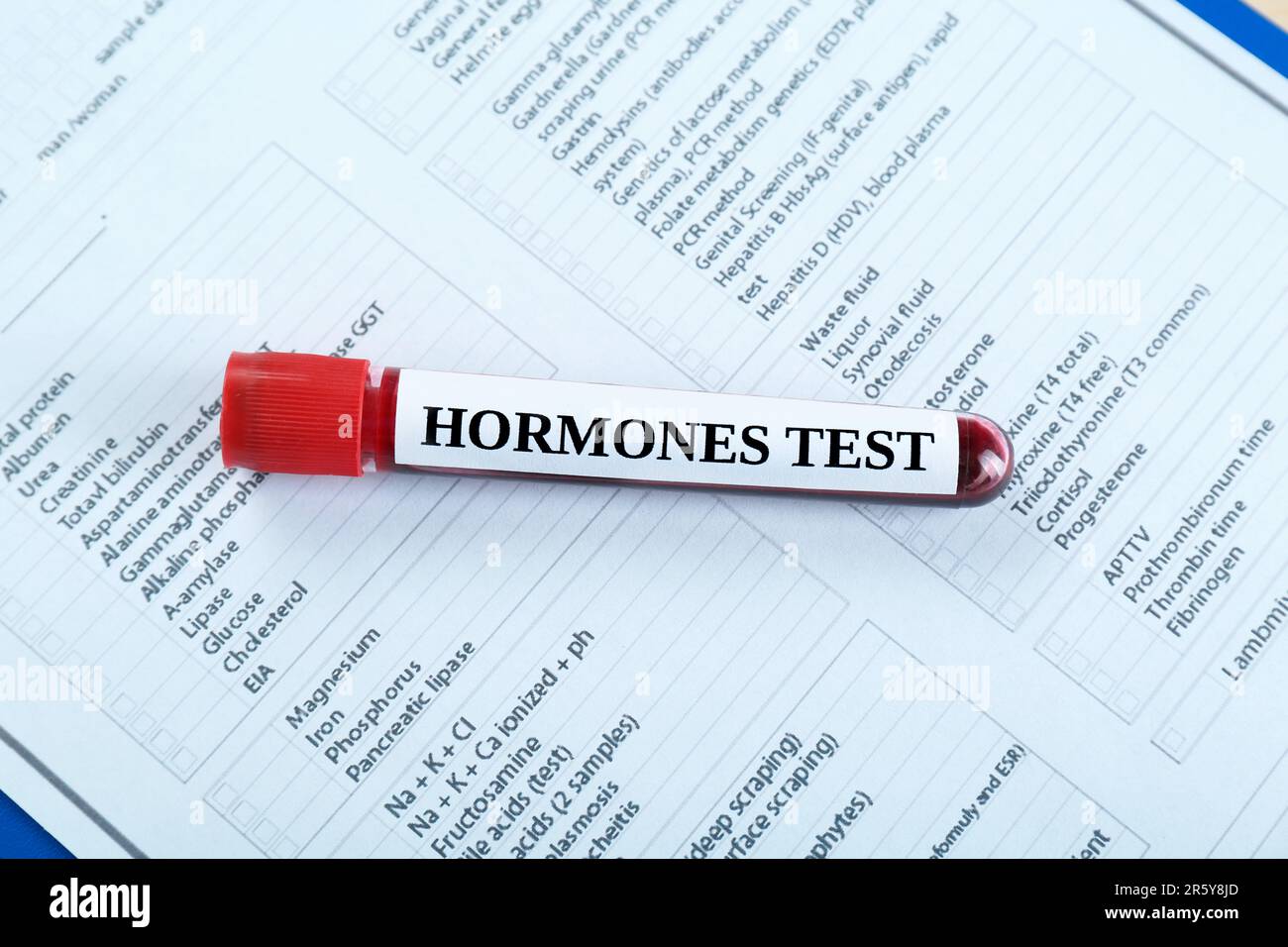 Hormones test. Sample tube with blood on laboratory form, top view ...