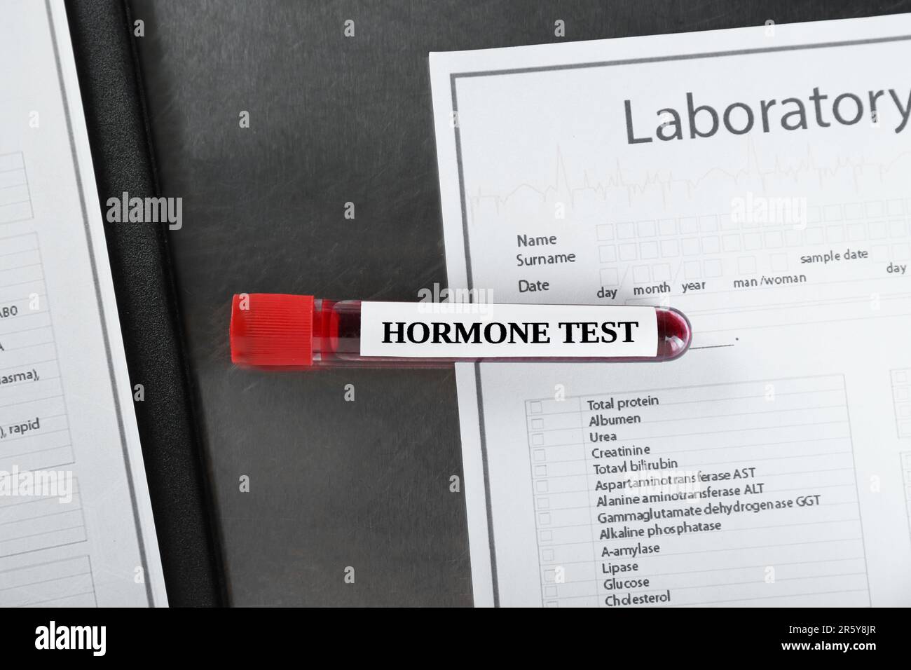 Glass tube with blood sample and label Hormone Test on metal table ...