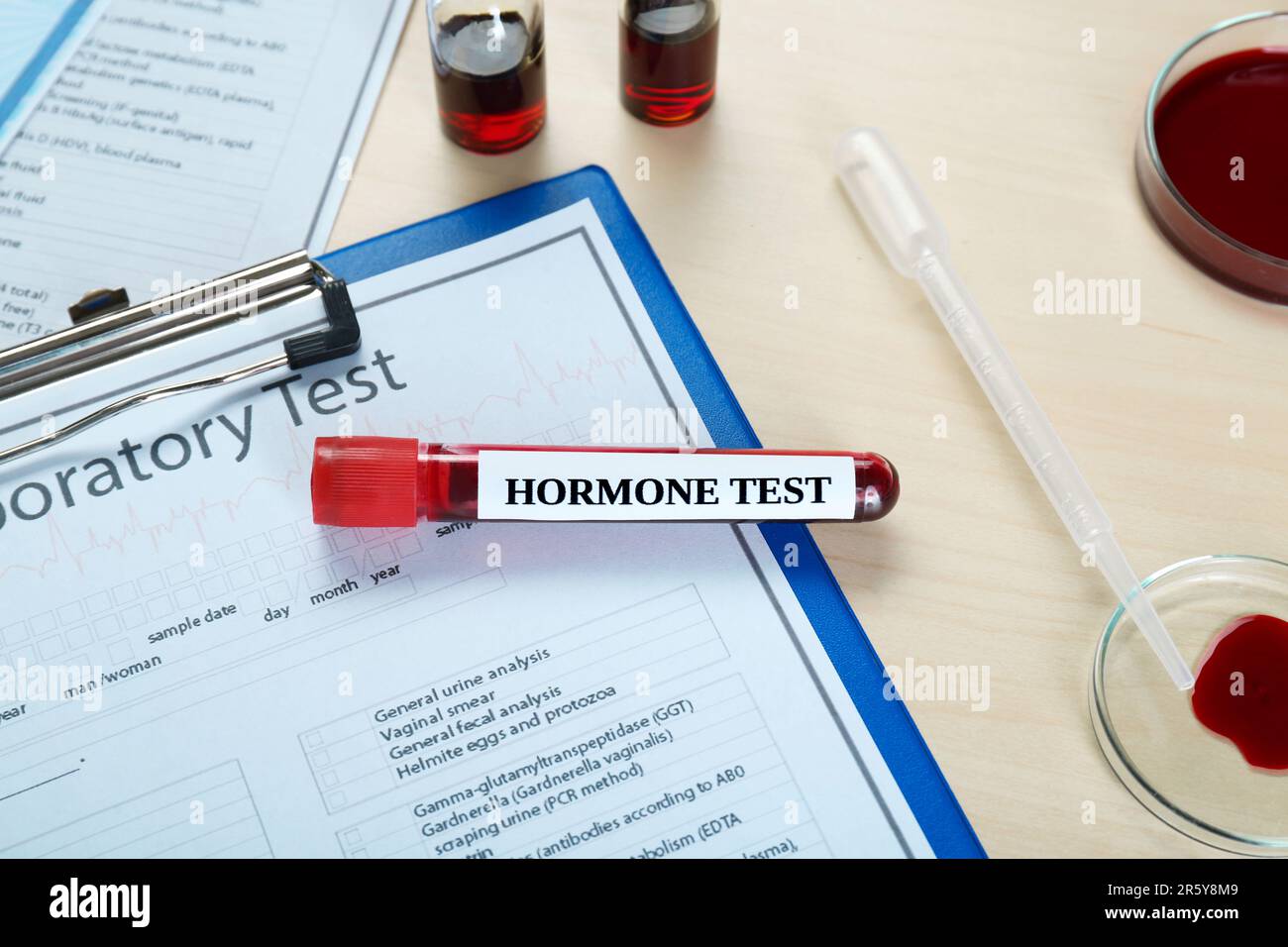 Hormone test. Sample tube with blood and laboratory form on table Stock ...