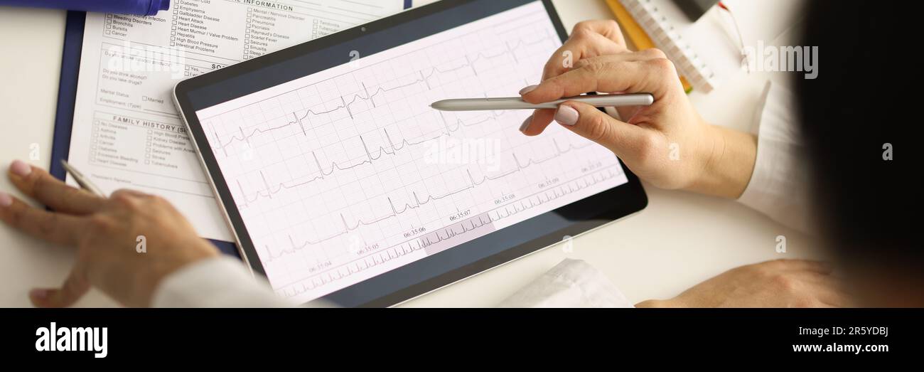 Doctor looks at ECG on tablet computer in cardiology center. Diagnosis ...
