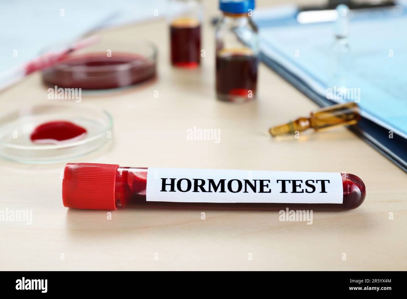 Hormone pregnancy test hi-res stock photography and images - Alamy