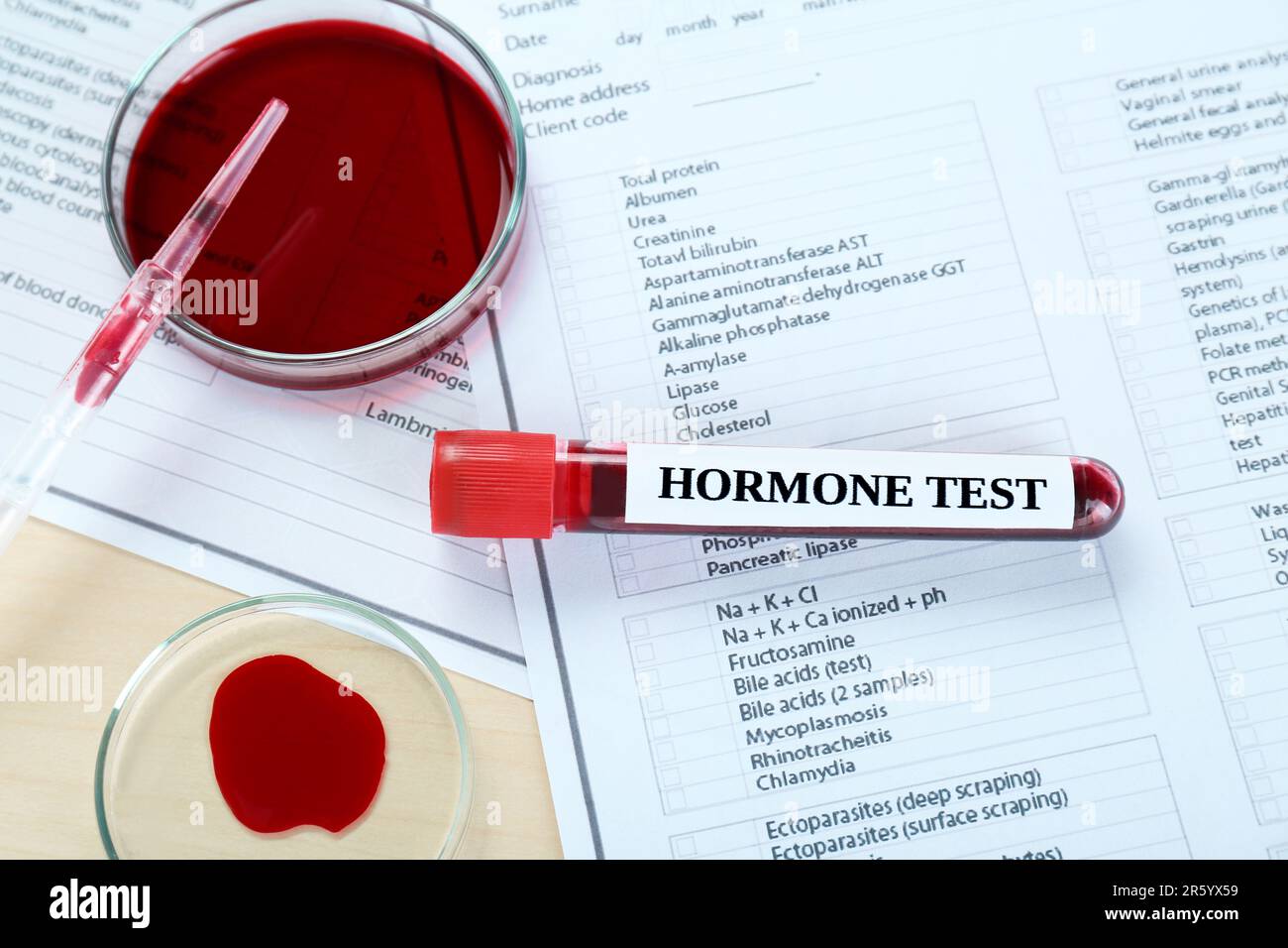Hormone test. Sample tube with blood and laboratory form on table, flat ...