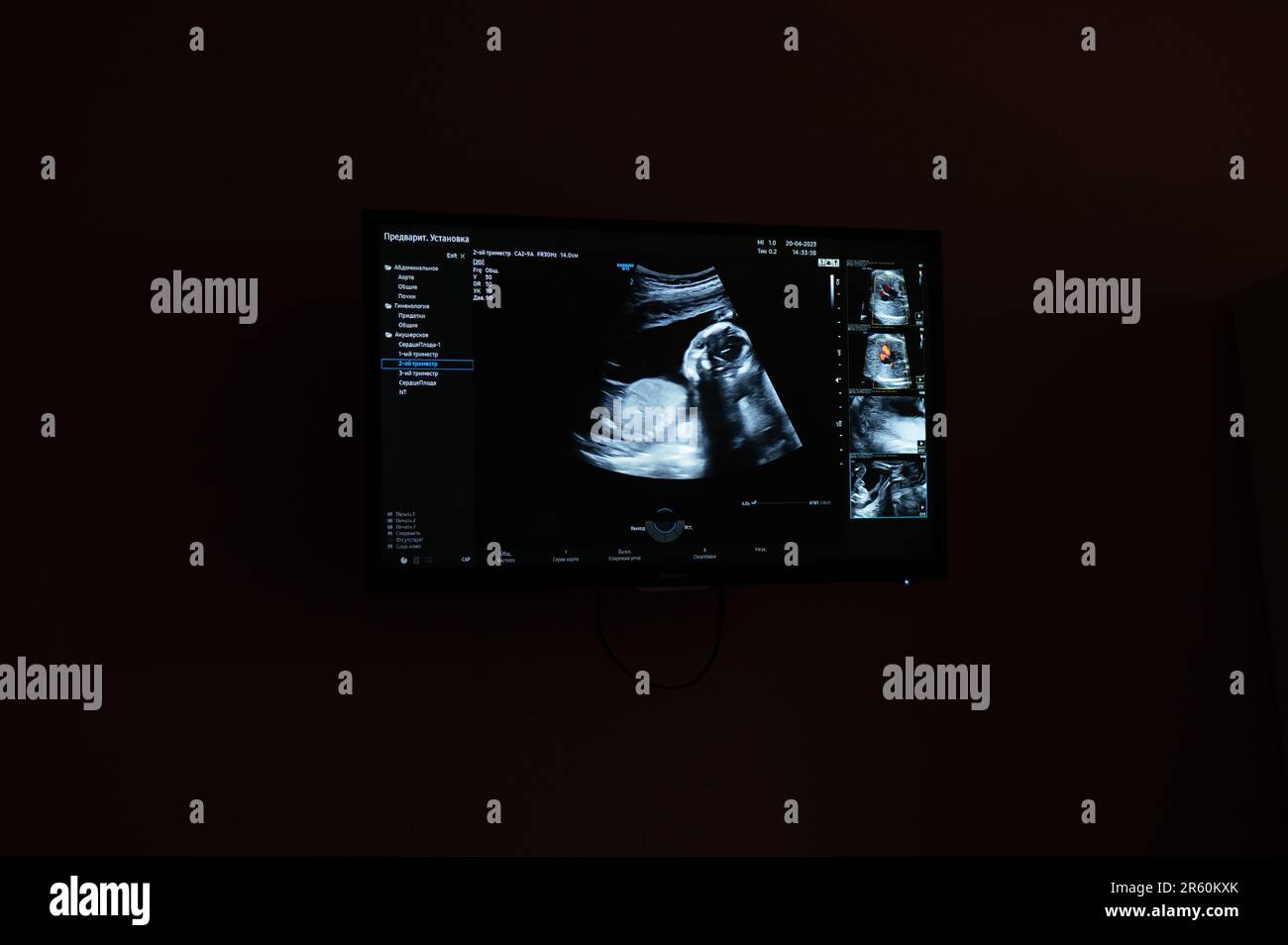 Maternity pregnancy ultrasound screening hi-res stock photography and ...