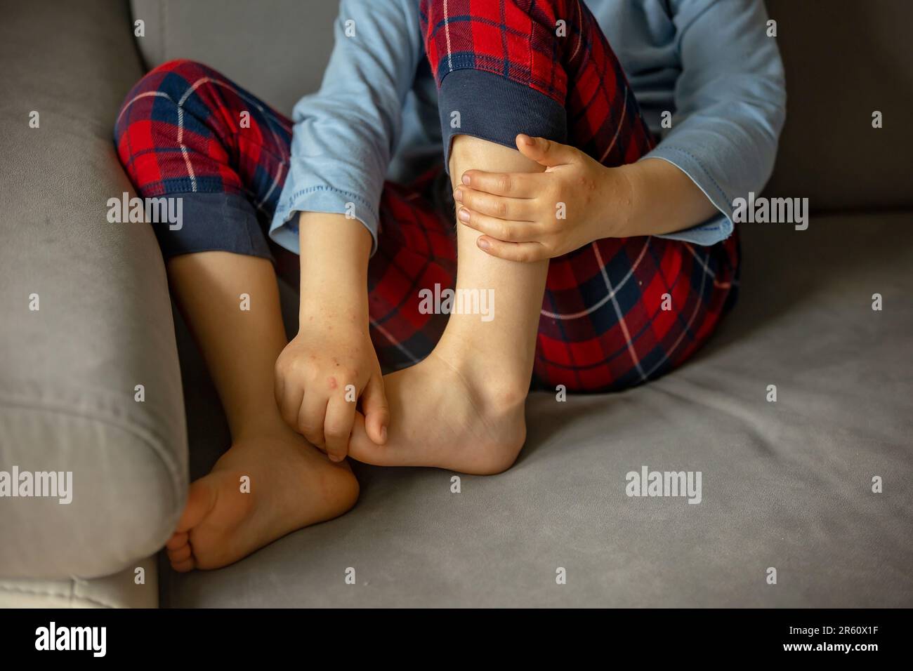 Child with skin rash, roseola, Hand-foot-and-mouth disease, child rash ...