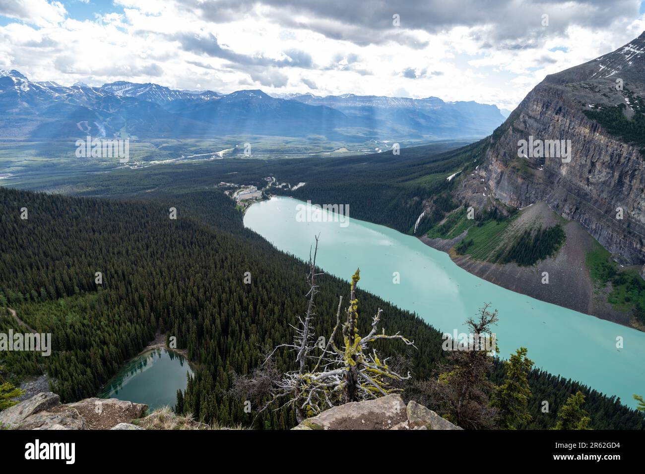 View of Lake Louise from the top of Big Beehive hike, with sunbeams ...