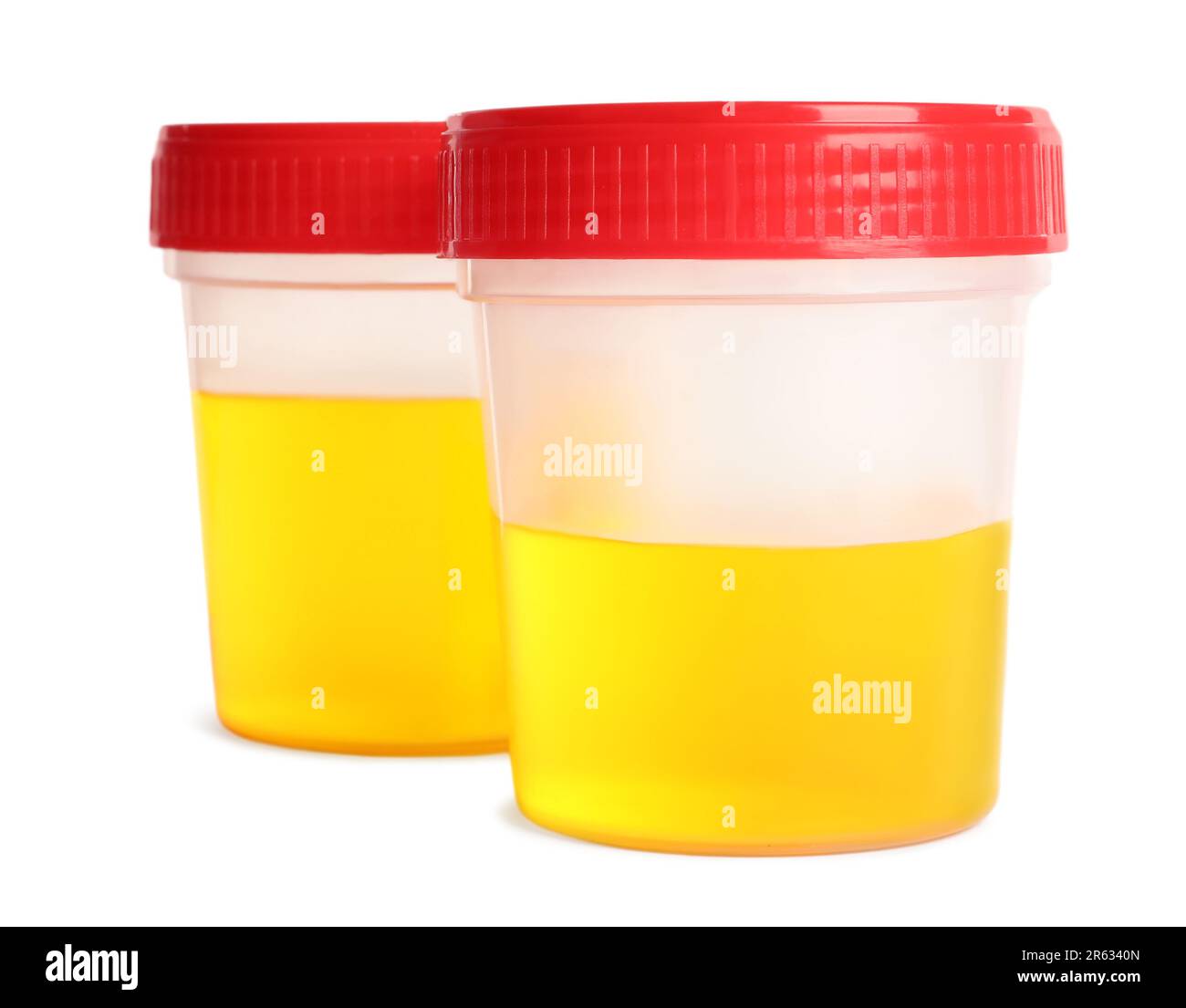 Containers with urine sample for analysis on white background Stock ...