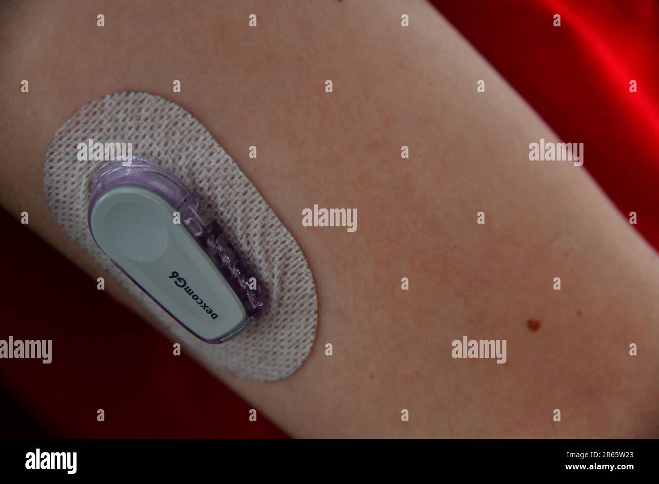 Dexcom g6 sensor hi-res stock photography and images - Alamy
