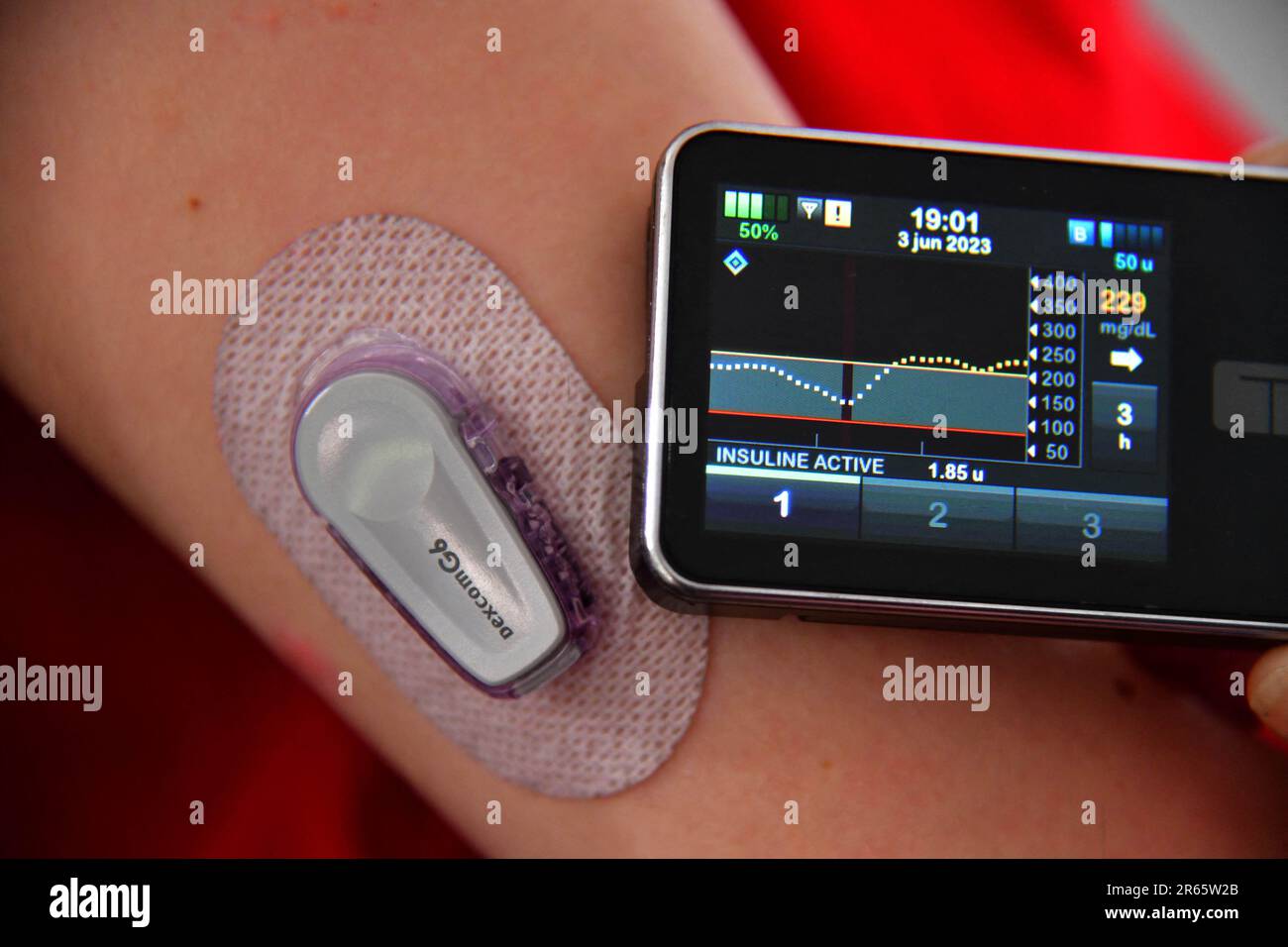 Peille, France. 03rd June, 2023. A young woman with diabetes monitors ...