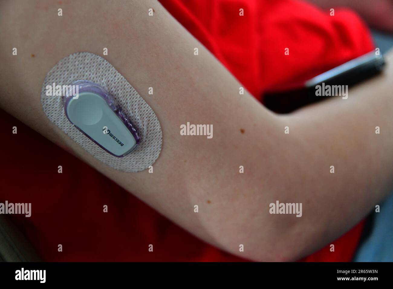 Dexcom g6 sensor hi-res stock photography and images - Alamy