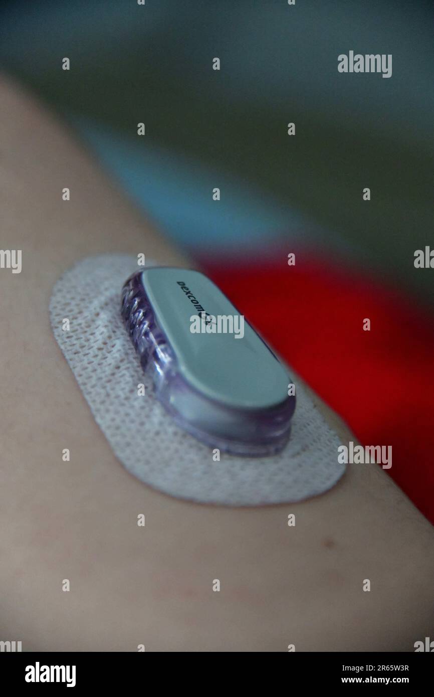 Peille, France. 03rd June, 2023. A young woman with diabetes monitors ...