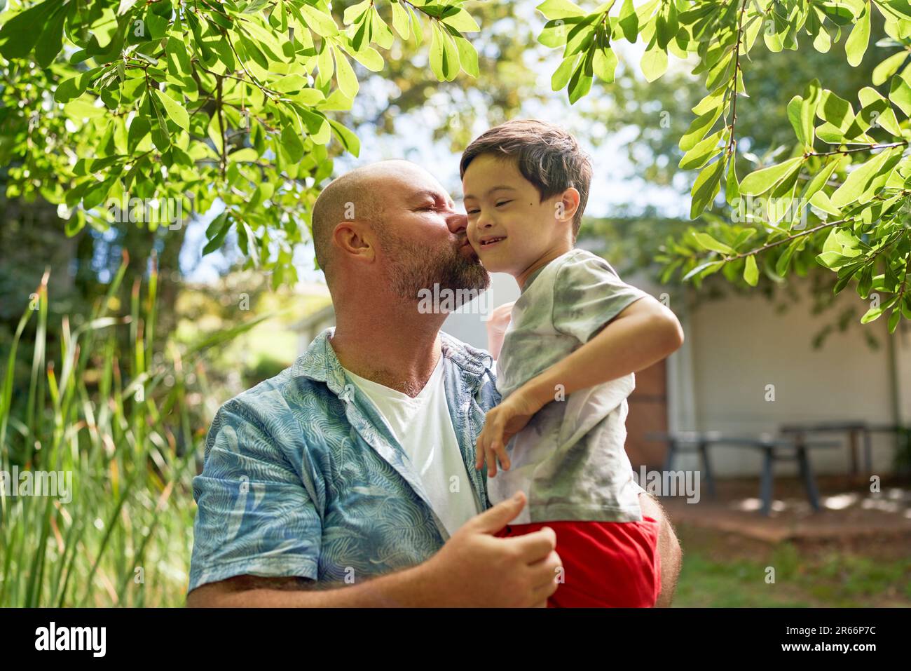 Father kissing happy, cute son with Down Syndrome in summer backyard ...