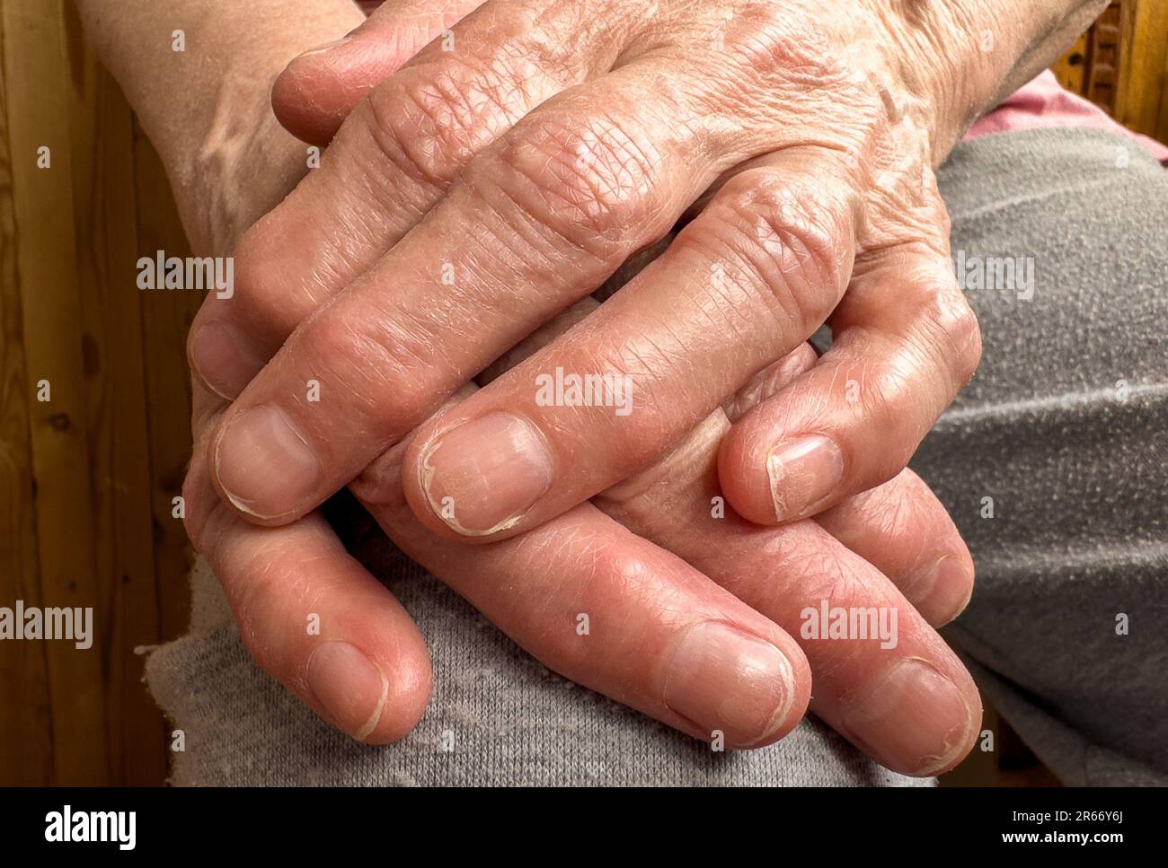 Old senior elderly aged women hands close-up, wrinkled fingers Stock ...
