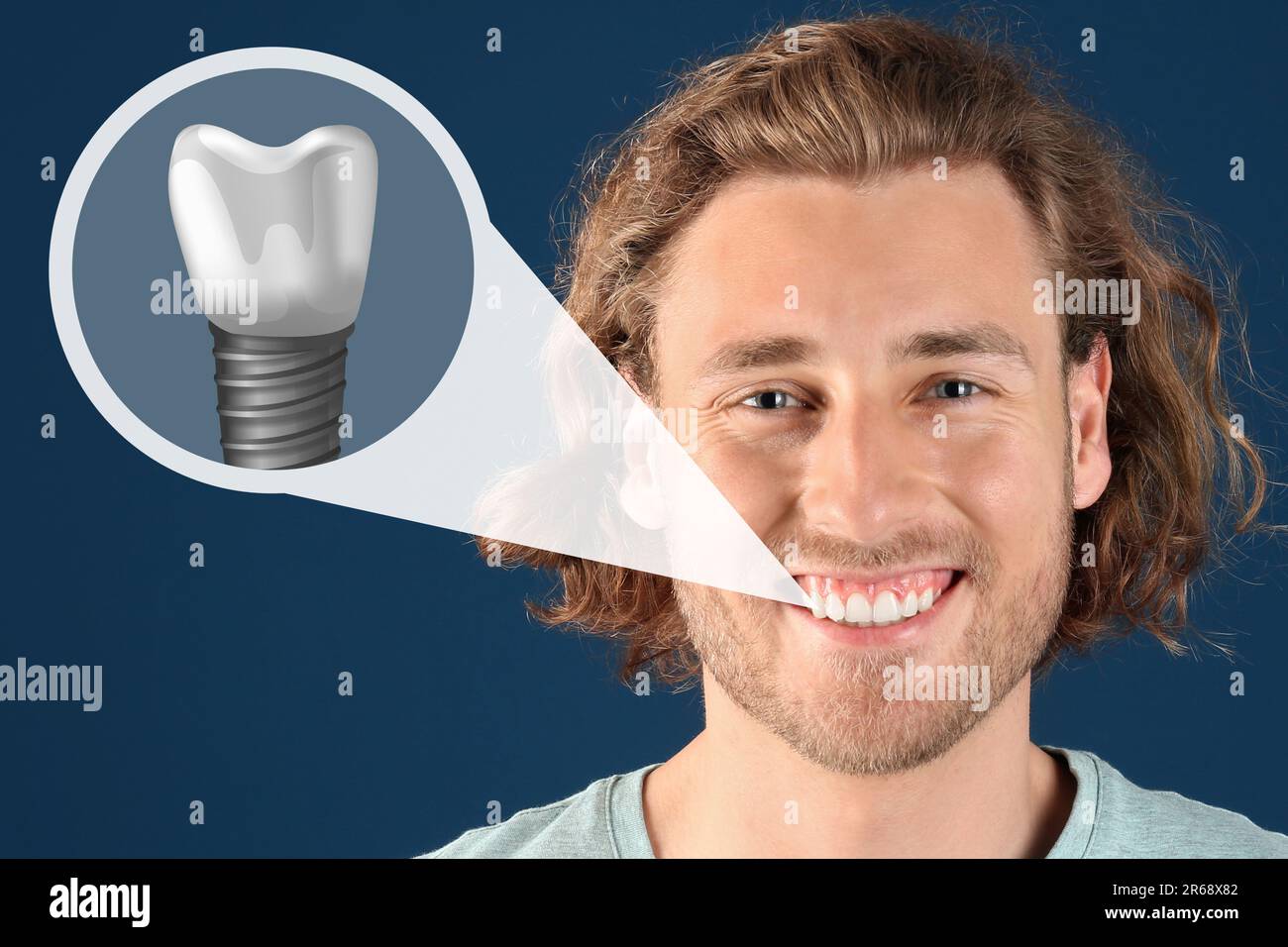 Happy man with perfect teeth smiling on dark blue background ...