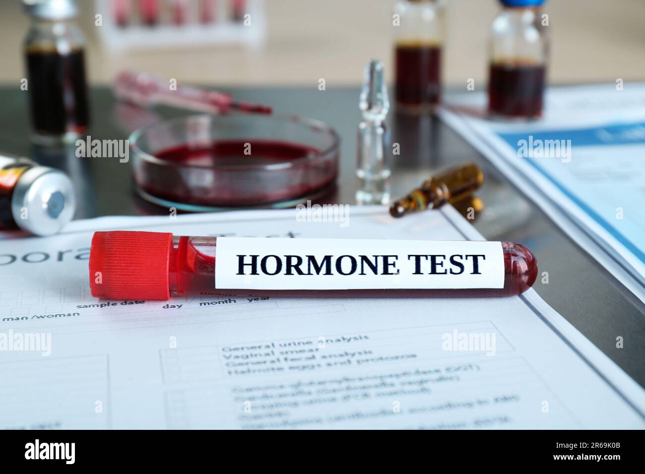 Glass tube with blood sample and label Hormone Test on table Stock ...