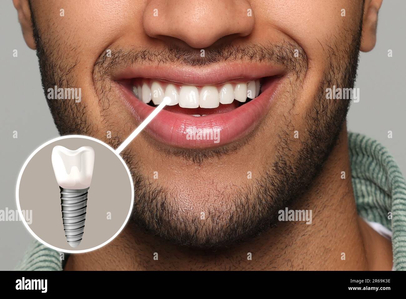 Happy man with perfect teeth smiling on grey background, closeup ...