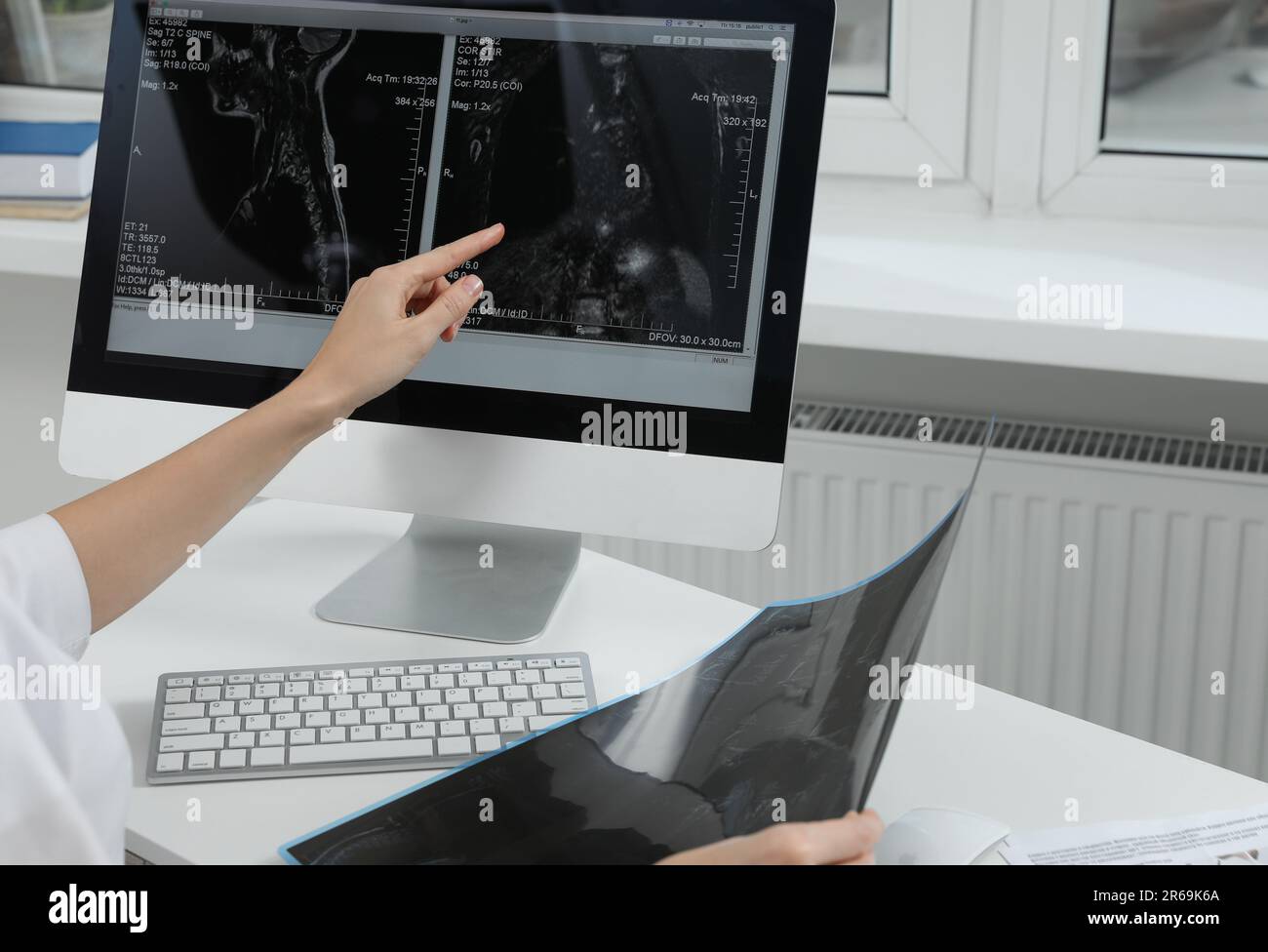 Doctor examining neck MRI image on computer in clinic, closeup Stock ...