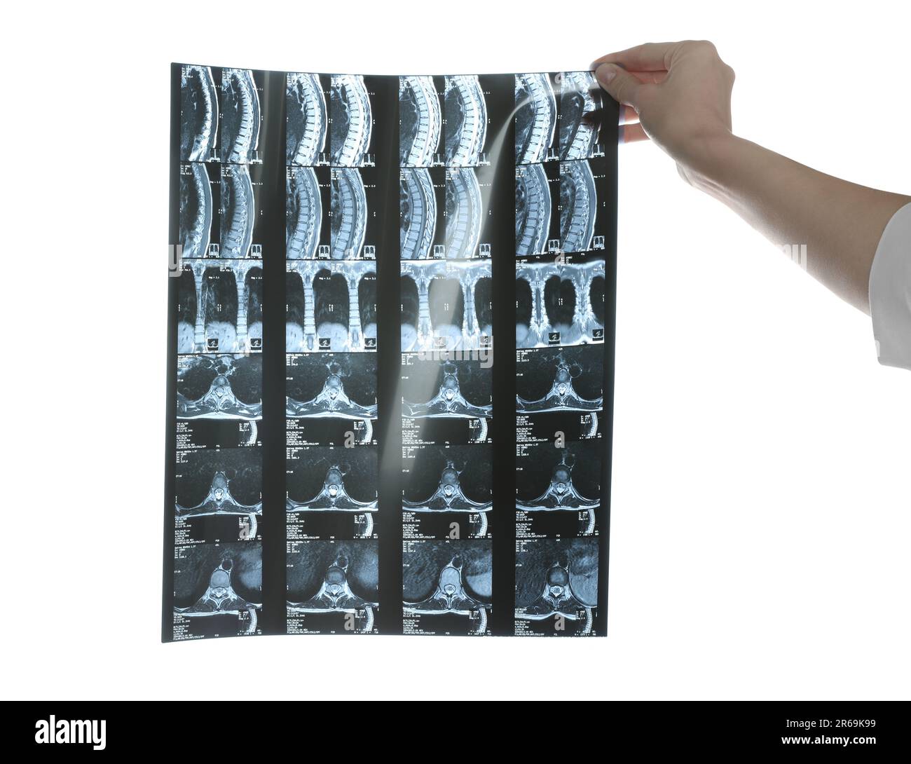 Doctor examining neck MRI image on white background, closeup Stock ...