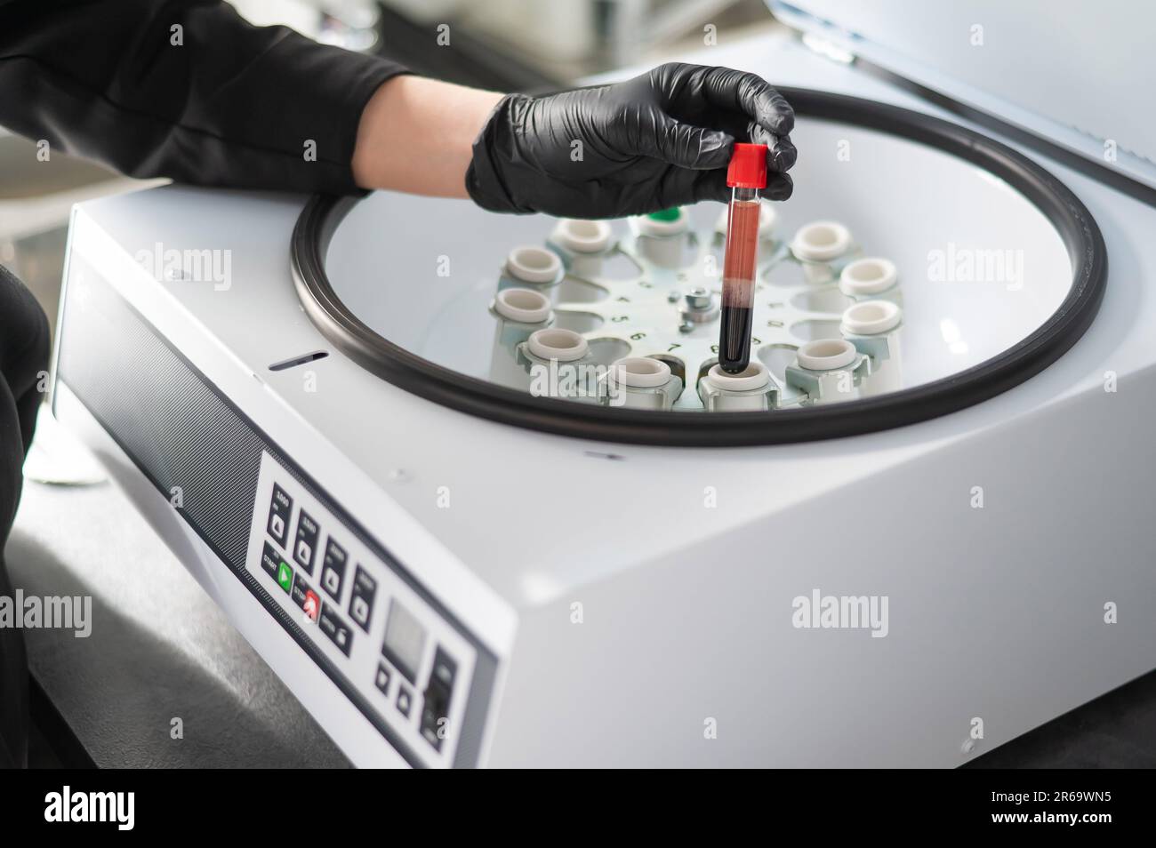 The doctor takes out a test tube with blood plasma from the centrifuge ...
